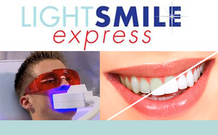 $39 For a Professional LED Light Accelerated Teeth Whitening Session ...