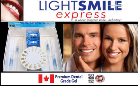 $39 for a Teeth Whitening Kit for 2 People, Including 2 LED Speed ...