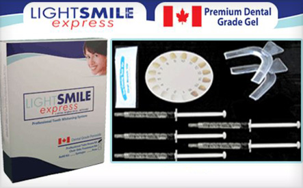 Up to 88% off Teeth Whitening Kits from Light Smile Express (2 Options ...